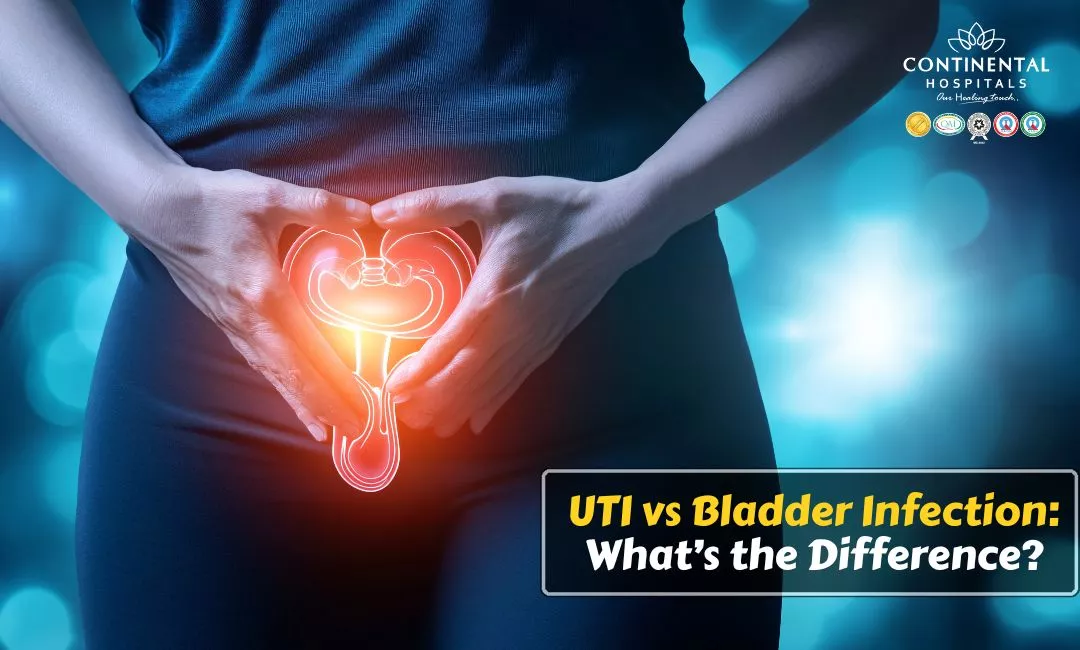 UTI vs Bladder Infection: What’s the Difference?