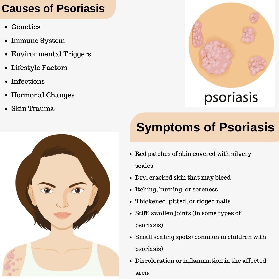 Psoriasis Causes Risk Factors Symptoms Treatment Psoriasis Causes Risk Factors Symptoms Treatment