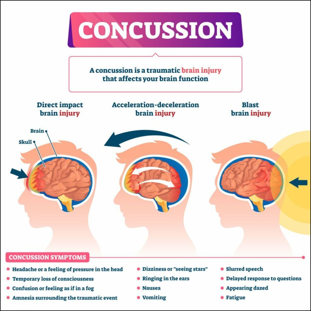 Concussion Causes Risk Factors Symptoms Treatment Concussion Causes Risk Factors Symptoms Treatment